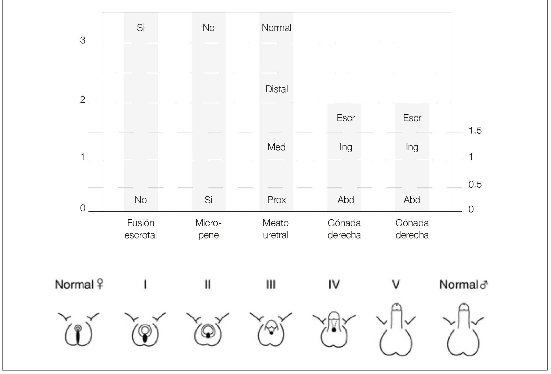 Puntuación del grado de masculinización de los genitales externos ...